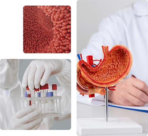 Disturbi Gastro Intestinali - Laboratorio Santilio